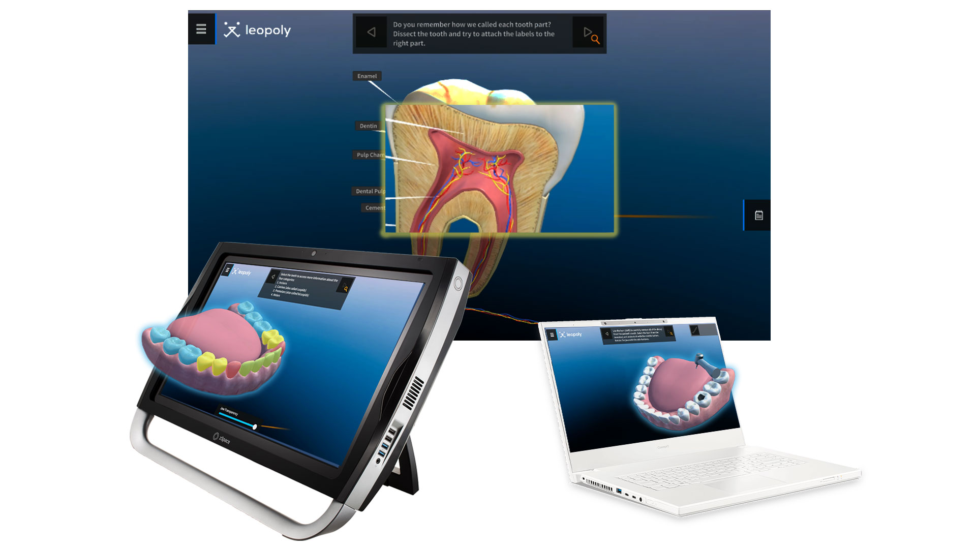 AIO-Inspire-IFP - Dental by Leopoly